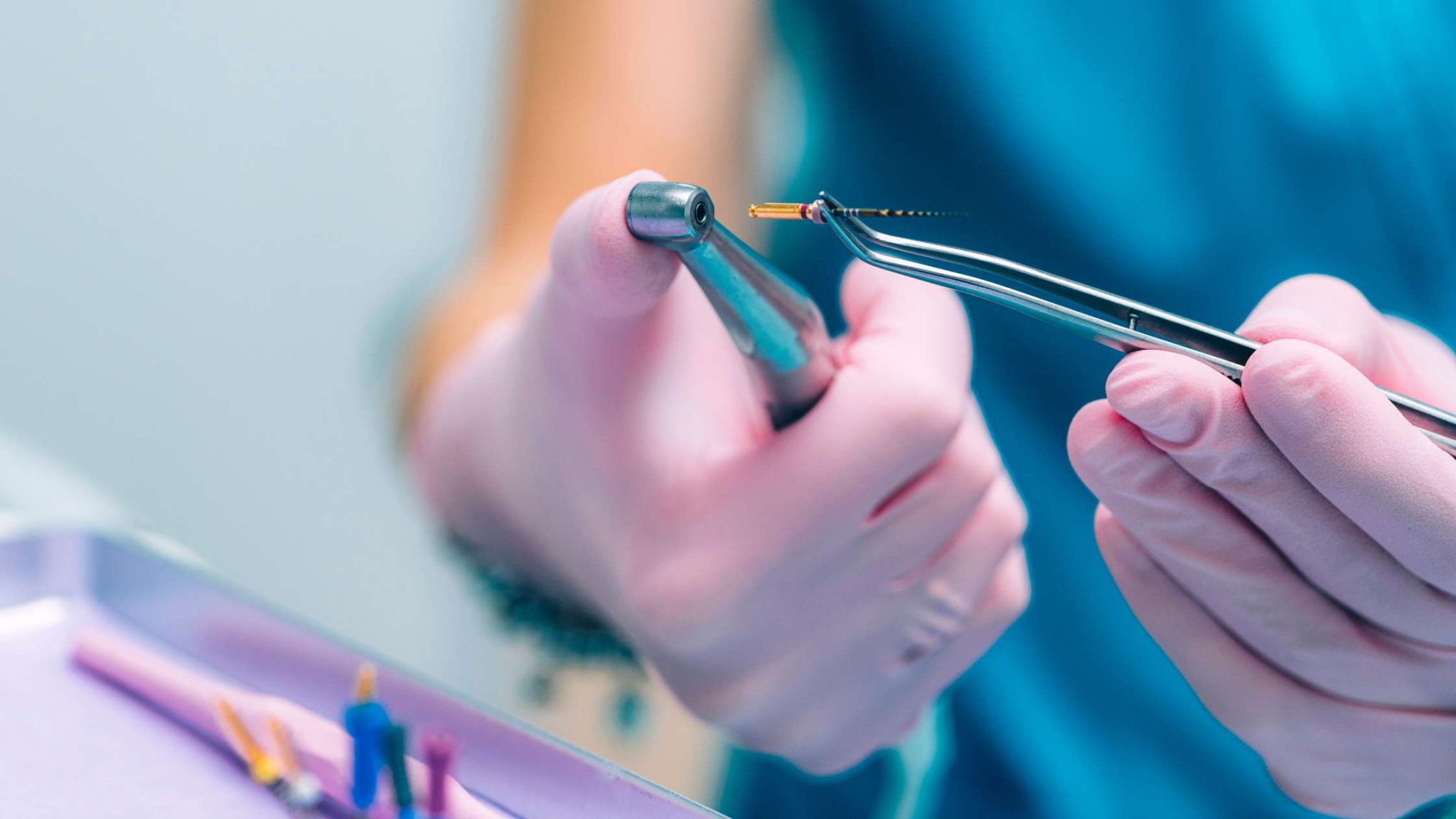 What is a Root Canal Procedure? - Hand Family Dentistry